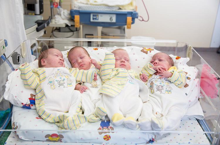 Vierlinge nach spontaner Schwangerschaft - MedMix