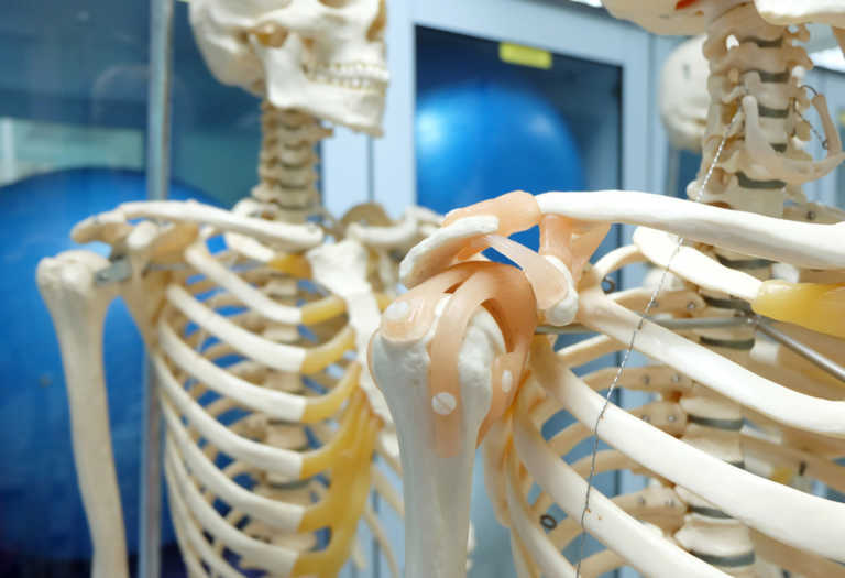 Stärkere Muskeln – Stärkere Knochen - MedMix