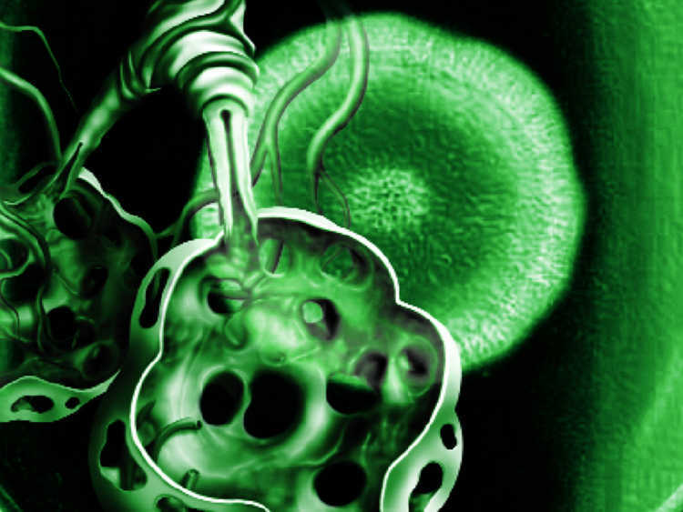 Antibiose bei COPD - MedMix