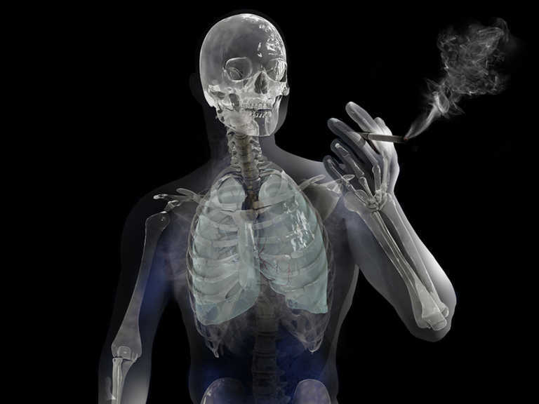 Rauchen und Lunge: COPD, Asthma bronchiale, Bronchuskarzinom etc.