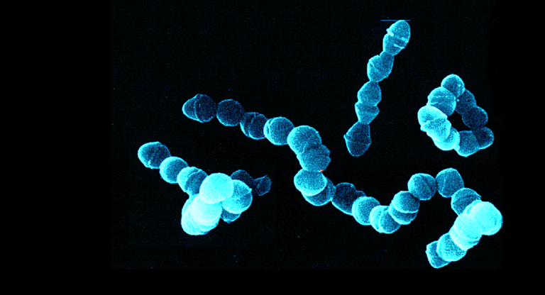 Antibiotika: Chinolone gegen ambulant erworbene Pneumonie