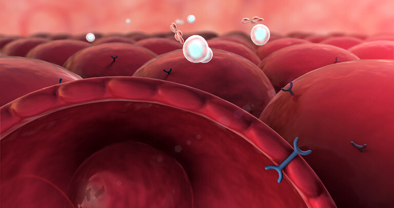 Beta-Zellen und die Diabetes-Entstehung - MedMix