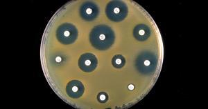 Antibiogramm für den gezielten, wirksamen Einsatz von Antibiotika