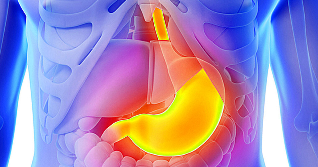 Protonenpumpeninhibitoren (PPI) nur nach eindeutiger Diagnose - MedMix