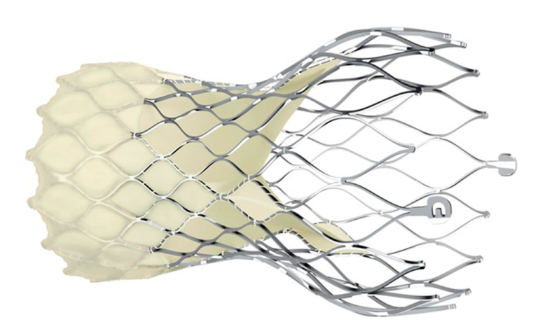 CoreValve Evolut Pro-Transkatheterklappe mit fortschrittlicher ...