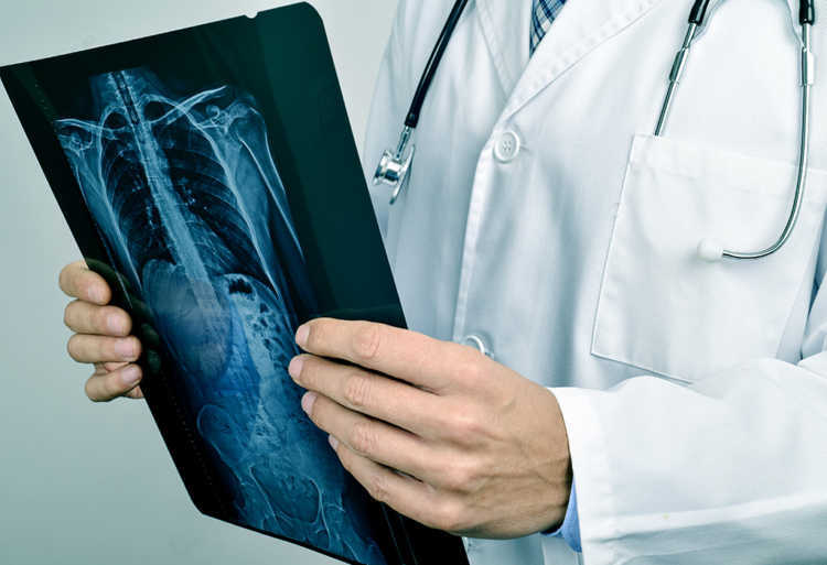 Rheuma erkennen mit neuen Screening-Konzepten zur Diagnose